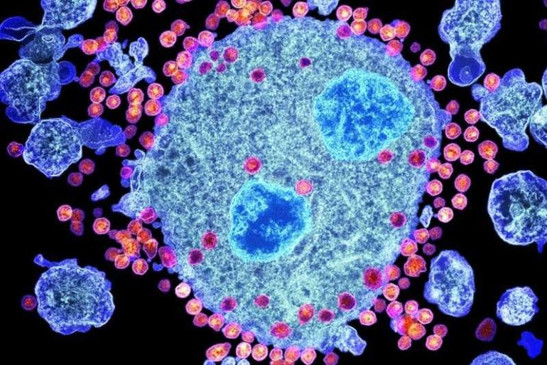 All About AIDS (Síndrome Da Imunodeficiência Adquirida) FAQ Do Paciente ...