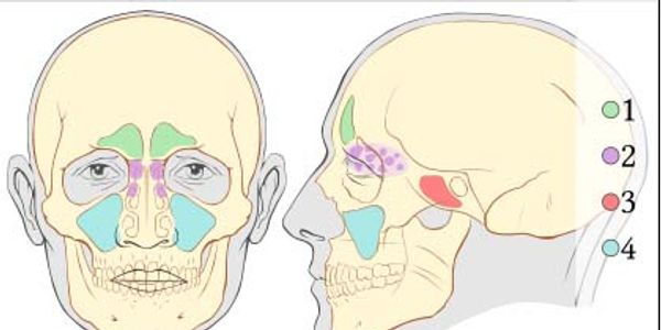 Cavidades Sinusais (Seios Paranasais) Localização, Anatomia, Fotos - PuroMD