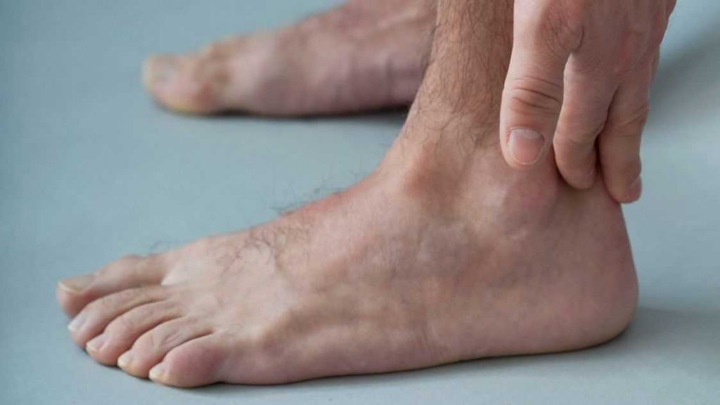 Tendão Inflamado (Tendinite) - Tipos, Causas, Sintomas, Tratamento - PuroMD