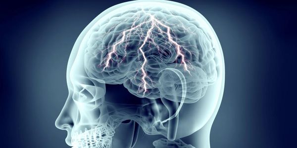 Convulsões (Ajustes) Tipos (Parcial E Generalizado) E Causas - PuroMD