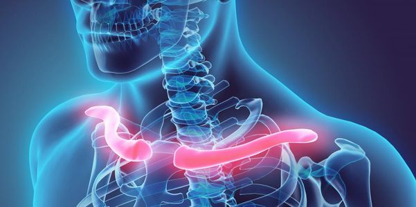 Dor Clavícula - Causas E Tratamento - PuroMD