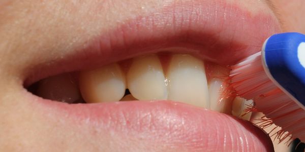 Tipos De Gengivite, Sintomas, Causas, Tratamento, Prevenção - PuroMD