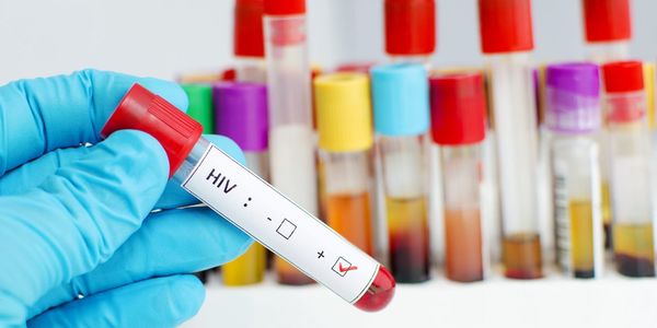 Testes Laboratoriais De HIV E Tipos De Testes Para Diagnóstico Ou ...