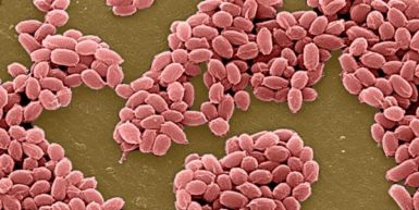 Infecção Humana Do Antraz (Bacillus Anthracis) - PuroMD