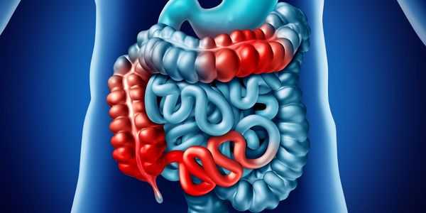 Colon Vs Intestino Grosso - Partes, Sintomas E Doenças - PuroMD