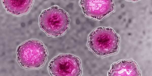 Co-Infecção Pelo Vírus Da Hepatite D (HDV), Superinfecção, Sintomas ...