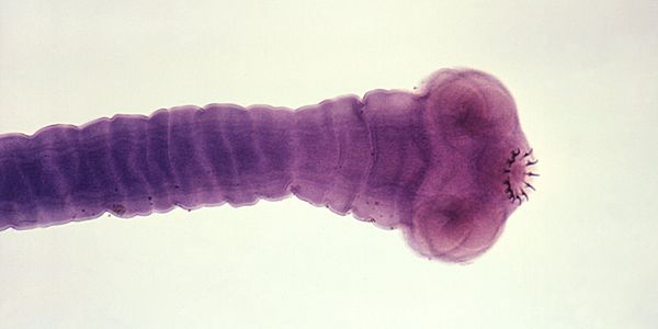 Taeníase (infecção Por Tênia Humana) - PuroMD