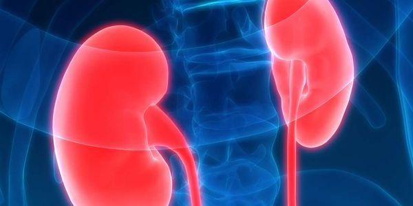 Nefrite (Inflamação Renal) Tipos, Sintomas, Complicações - PuroMD