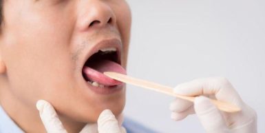 Anatomia E Função Da Úvula - PuroMD