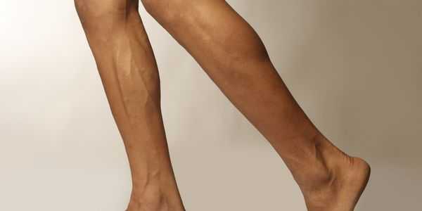 Pernas Fracas (Perda De Força Em Uma Ou Ambas As Pernas) Causas - PuroMD