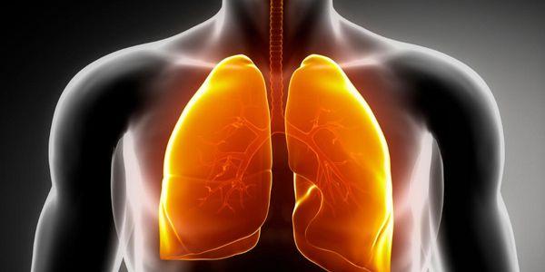 Pneumonia (Pulmão Inflamado) Tipos, Tosse, Sintomas, Riscos - PuroMD